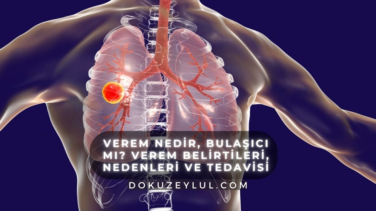Verem nedir, bulaşıcı mı? Verem belirtileri, nedenleri ve tedavisi ...